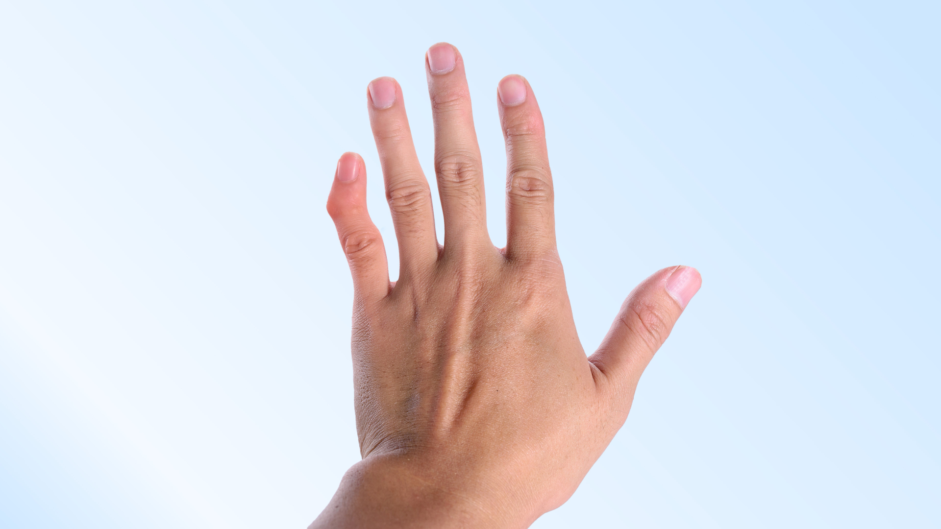 Zlomeniny - diagnostika, typy, účinné hojenie zlomenín