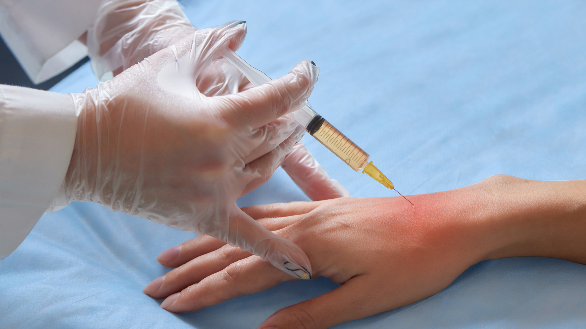 Zápal kĺbov ruky a zápästia - príčiny, účinná liečba