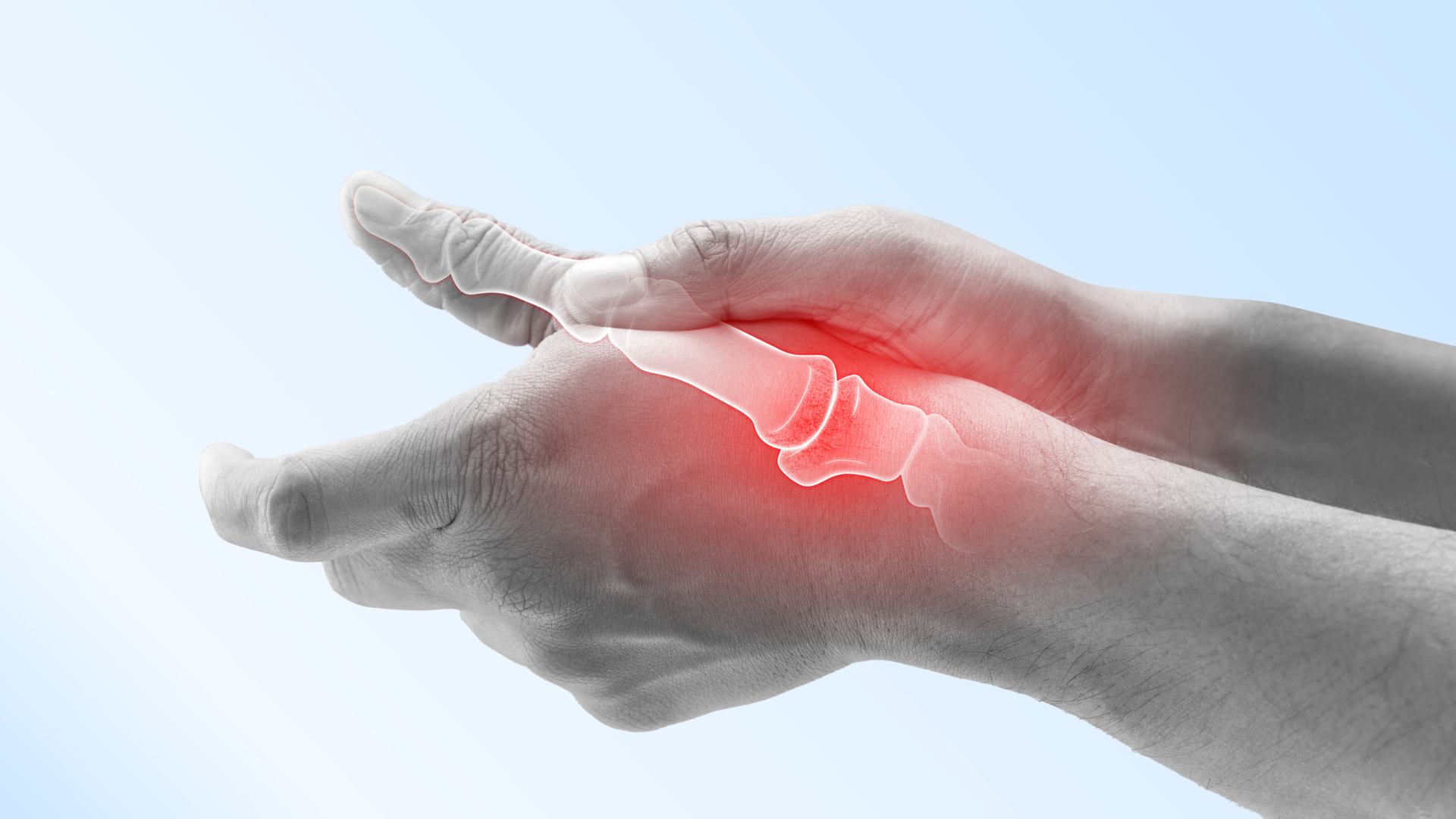 Zápal kĺbov ruky a zápästia - príčiny, účinná liečba